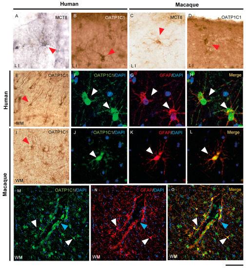 Thyroid Hormone Transporters MCT8 and OATP1C1 Are Expressed in ...