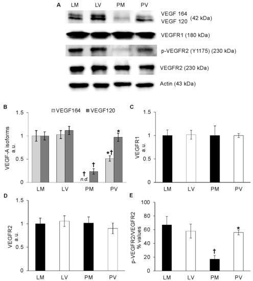 Do Aging and Parity Affect VEGF-A/VEGFR Content and Signaling in the ...