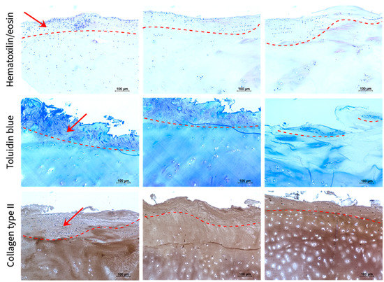 IJMS | Free Full-Text | Chondroitin Sulfate-Tyramine-Based Hydrogels ...