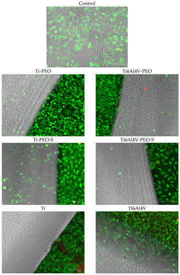 An Experimental Anodized and Low-Pressure Oxygen Plasma-Treated ...