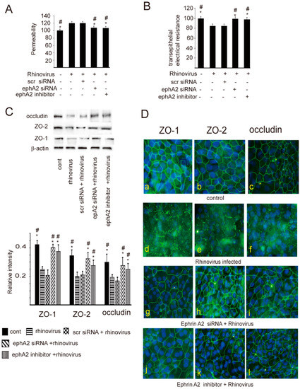 The EphA1 and EphA2 Signaling Modulates the Epithelial Permeability in ...