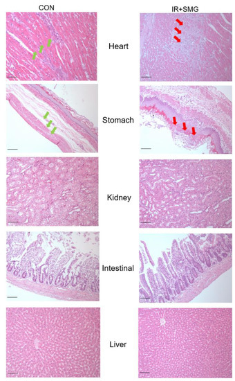 The Biological Implication of Semicarbazide-Sensitive Amine Oxidase ...