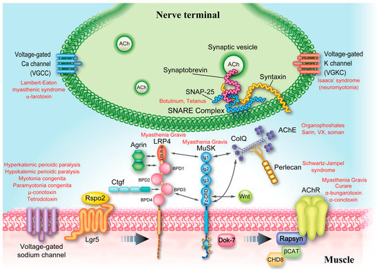 IJMS | Free Full-Text | Clinical and Pathologic Features of Congenital ...