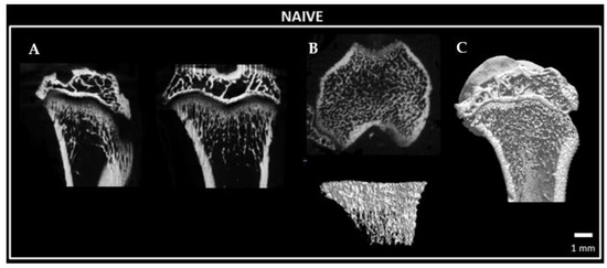 Pathophysiological Aspects of Muscle Atrophy and Osteopenia Induced by ...