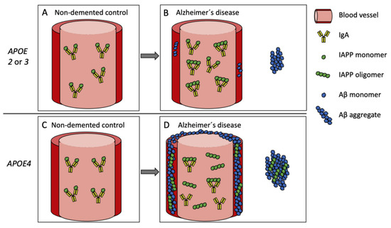 Plasma IAPP-Autoantibody Levels in Alzheimer’s Disease Patients Are Affected by APOE4 Status