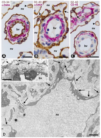 IJMS | Free Full-Text | Delimiting CD34+ Stromal Cells/Telocytes Are ...