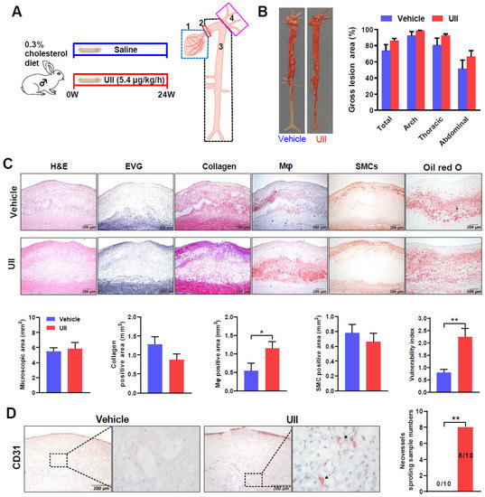 Urotensin II Enhances Advanced Aortic Atherosclerosis Formation and ...
