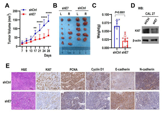 SRSF3-Mediated Ki67 Exon 7-Inclusion Promotes Head and Neck Squamous ...