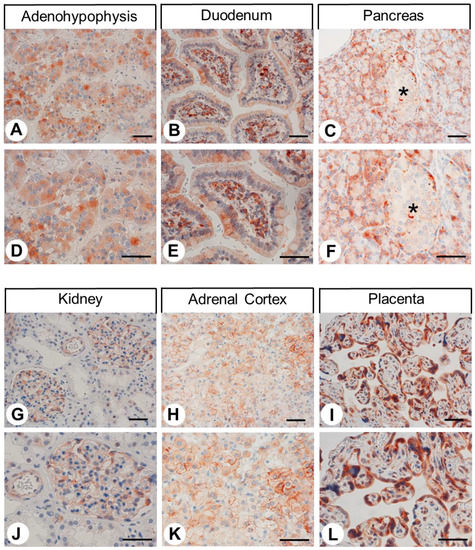 Expression of the Calcitonin Receptor-like Receptor (CALCRL) in Normal ...