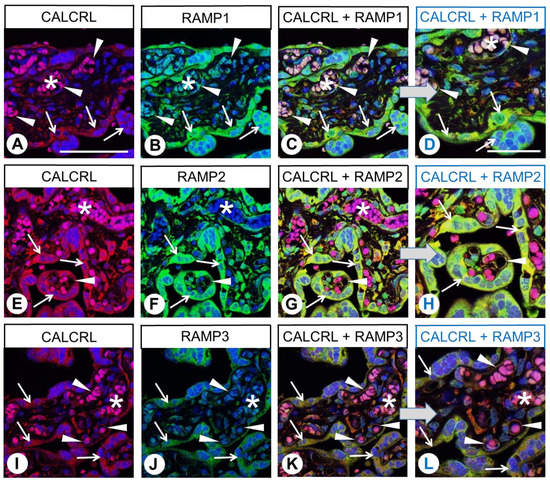 Expression of the Calcitonin Receptor-like Receptor (CALCRL) in Normal ...