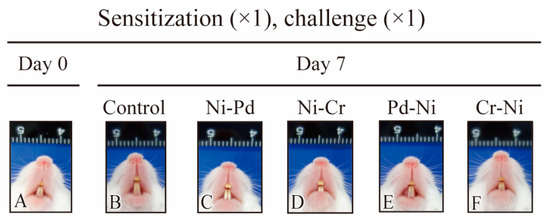 Cross-Reactivity of Intraoral Allergic Contact Mucositis in the Nickel ...