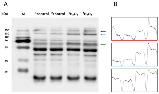 Imaging and Characterization of Oxidative Protein Modifications in Skin