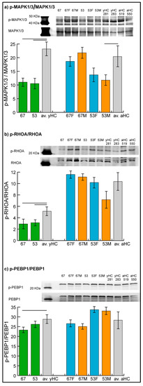 Changes of RAS Pathway Phosphorylation in Lymphoblastoid Cell Lines ...