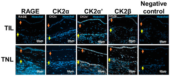 Characterization of RAGE and CK2 Expressions in Human Fetal Membranes