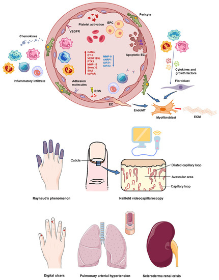 IJMS | Free Full-Text | Current Trends in Vascular Biomarkers for ...