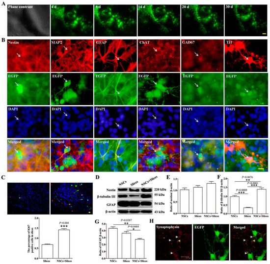 The Biological Behaviors of Neural Stem Cell Affected by ...