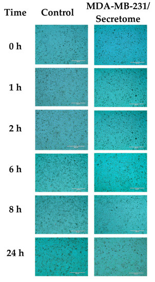 E. coli Secretome Metabolically Modulates MDA-MB-231 Breast Cancer ...