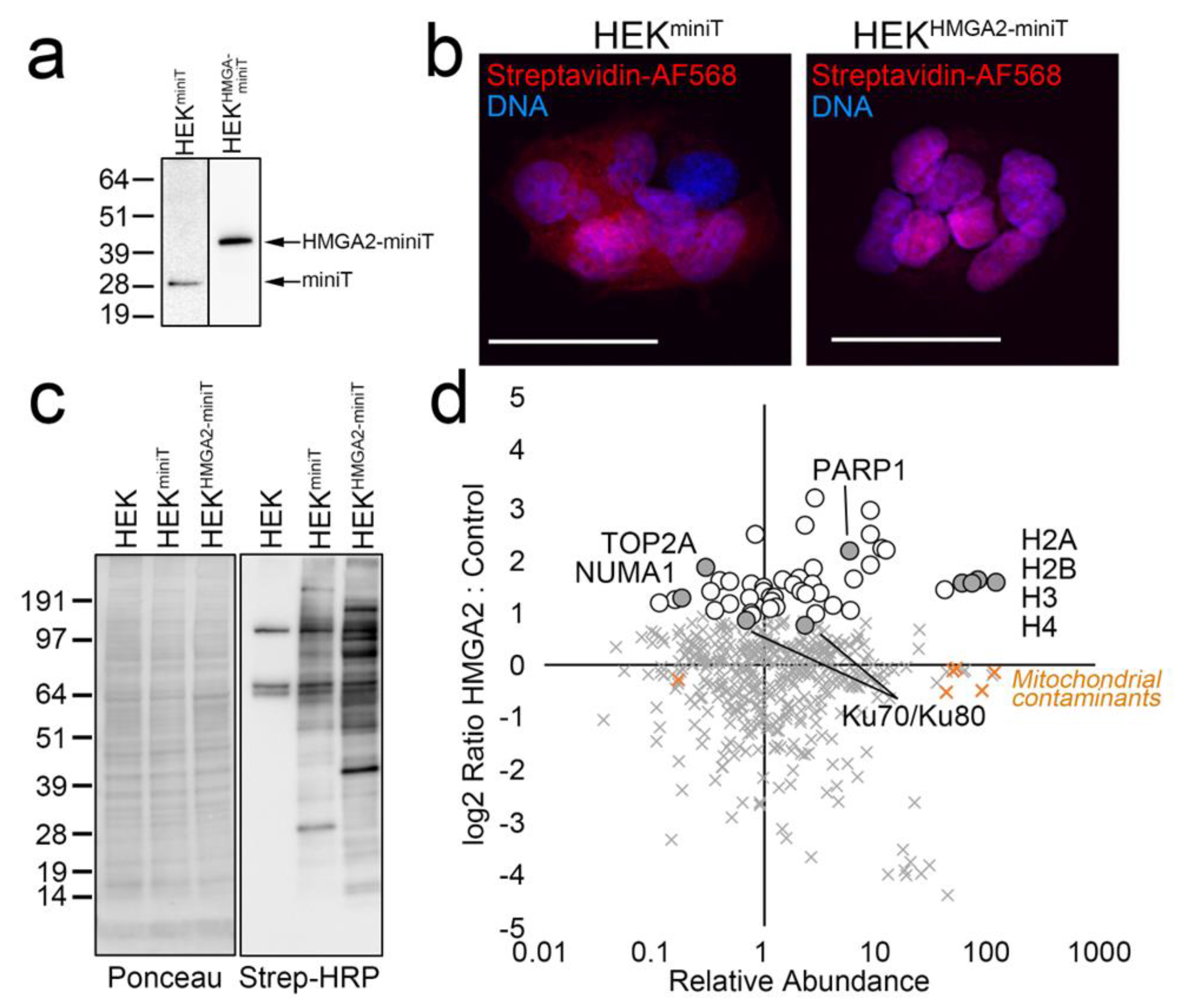 IJMS | Free Full-Text | Nuclear High Mobility Group A2 (HMGA2 ...