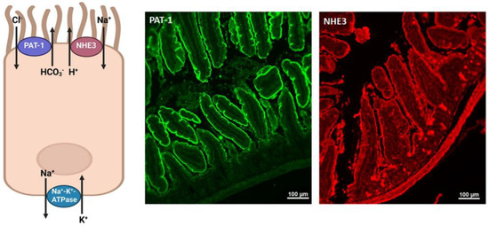 Pathogenesis of Hypertension in Metabolic Syndrome: The Role of ...