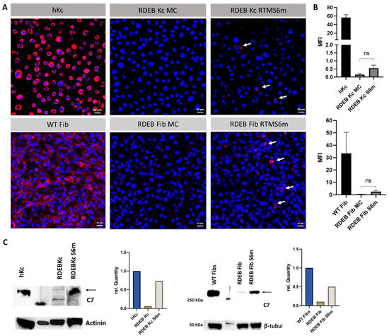 COL7A1 Editing via RNA Trans-Splicing in RDEB-Derived Skin Equivalents