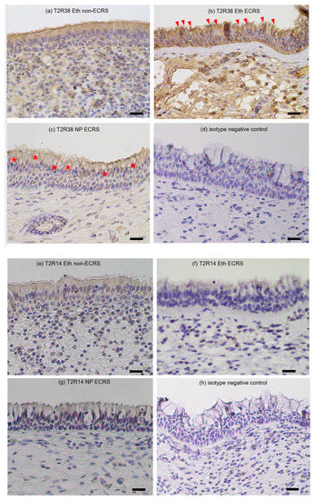 Functional Alteration and Differential Expression of the Bitter Taste ...