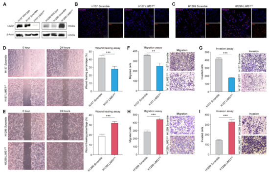 Comprehensive Analyses and Immunophenotyping of LIM Domain Family Genes ...