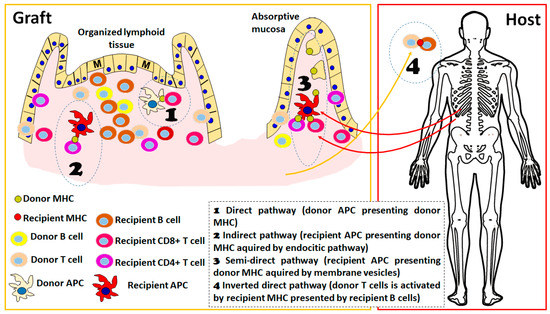 Intestinal Transplant Immunology and Intestinal Graft Rejection: From ...