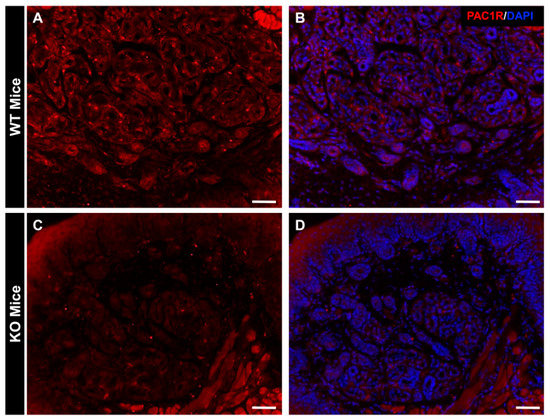Molecular and Physiological Functions of PACAP in Sweat Secretion