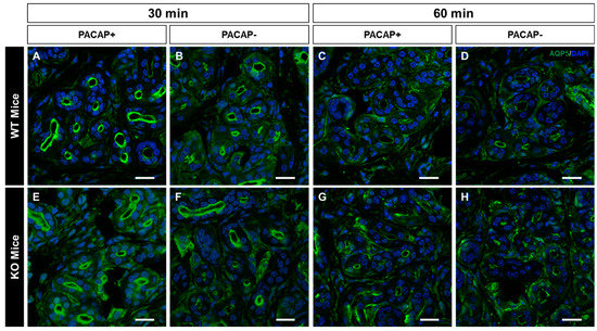 Molecular and Physiological Functions of PACAP in Sweat Secretion