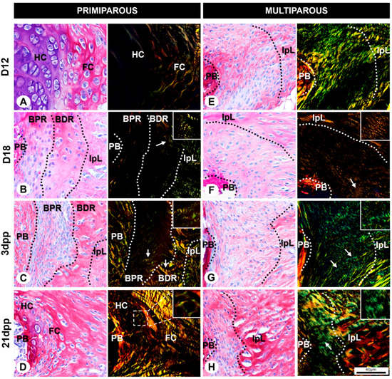 Multiparity and Aging Impact Chondrogenic and Osteogenic Potential at ...