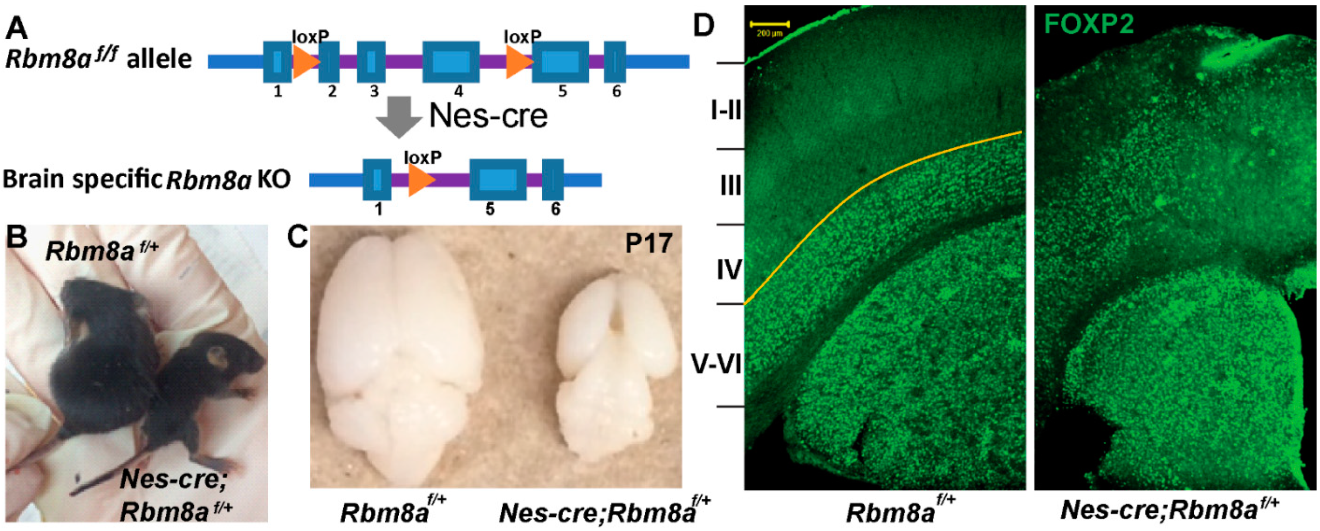 Transcriptomic Analyses of Brains of RBM8A Conditional Transcriptomic Analyses of Brains of RBM8A Conditional