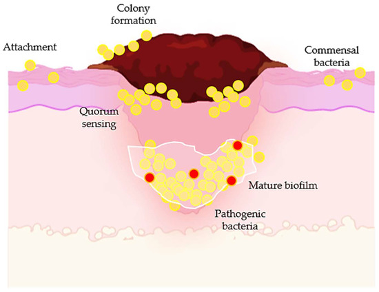 Flavonoids as Potential Wound-Healing Molecules: Emphasis on Pathways ...
