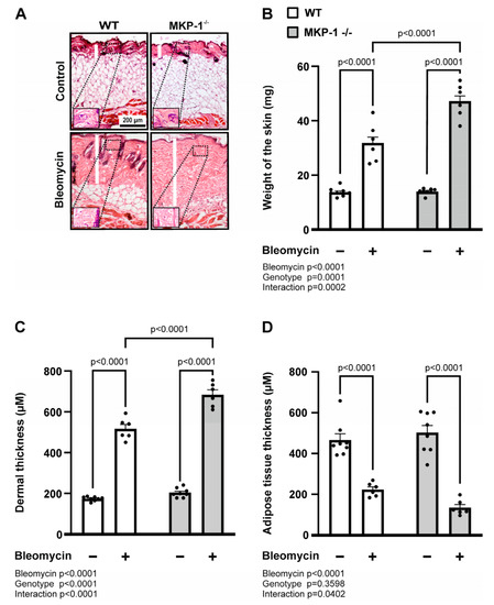 MKP-1 Deficiency Exacerbates Skin Fibrosis in a Mouse Model of Scleroderma