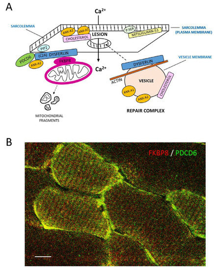 Analysis of Dysferlin Direct Interactions with Putative Repair Proteins Links Apoptotic ...