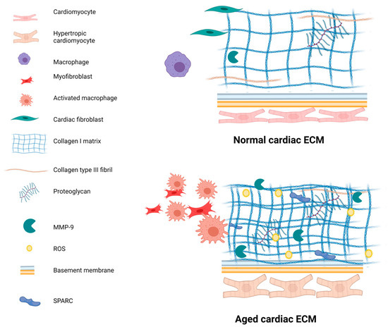 IJMS | Free Full-Text | Framing Heartaches: The Cardiac ECM and the ...