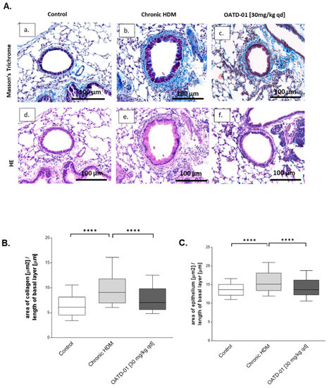 Inhibition of Macrophage-Specific CHIT1 as an Approach to Treat Airway ...