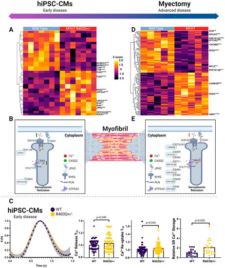 Multi-Omics Profiling of Hypertrophic Cardiomyopathy Reveals Altered Mechanisms in Mitochondrial ...