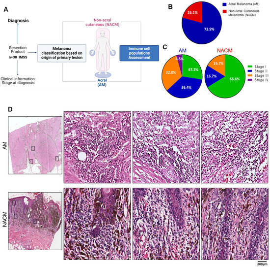 Acral Melanoma Is Infiltrated with cDC1s and Functional Exhausted CD8 T ...