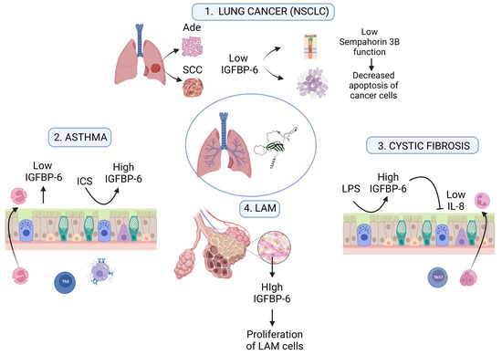 IGFBP-6 Network in Chronic Inflammatory Airway Diseases and Lung Tumor ...