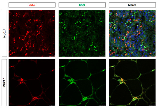 MUC1 Expression Affects the Immunoflogosis in Renal Cell Carcinoma ...
