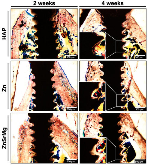 Vapor-Induced Pore-Forming Atmospheric-Plasma-Sprayed Zinc-, Strontium ...