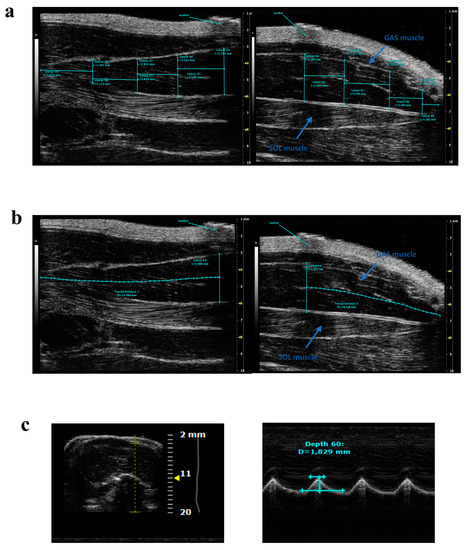 Preclinical Ultrasonography in Rodent Models of Neuromuscular Disorders ...