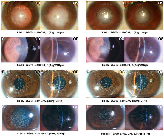 Variant Landscape of 15 Genes Involved in Corneal Dystrophies: Report ...