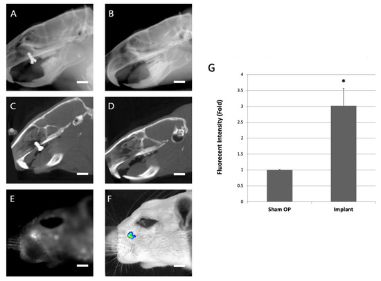 A Non-Invasive Method for Monitoring Osteogenesis and Osseointegration ...