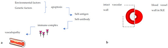 Systemic Lupus Erythematosus and Pulmonary Hypertension