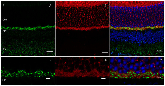 Ribbon Synapses and Retinal Disease: Review