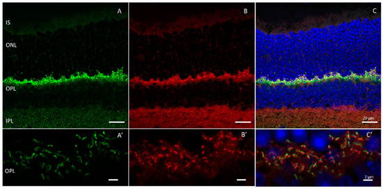 Ribbon Synapses and Retinal Disease: Review