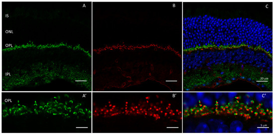 Ribbon Synapses and Retinal Disease: Review