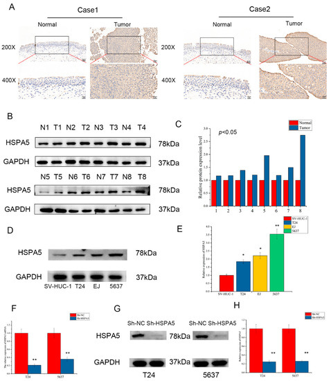 HSPA5 Promotes the Proliferation, Metastasis and Regulates Ferroptosis ...