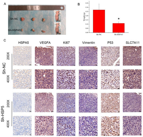 HSPA5 Promotes the Proliferation, Metastasis and Regulates Ferroptosis ...